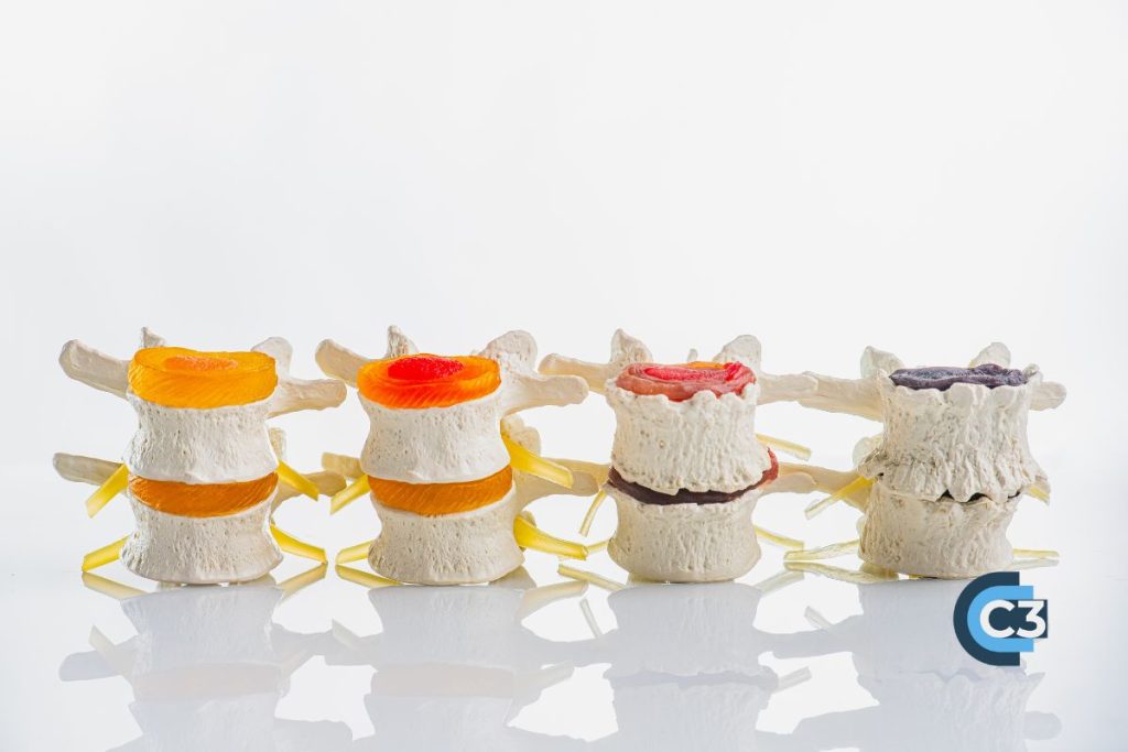 Why It Matters When Considering Degenerative Changes - Clinical ...